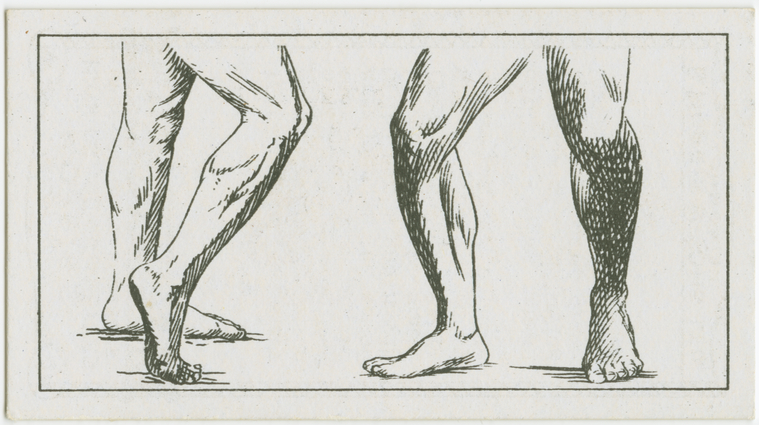 The legs. - NYPL Digital Collections