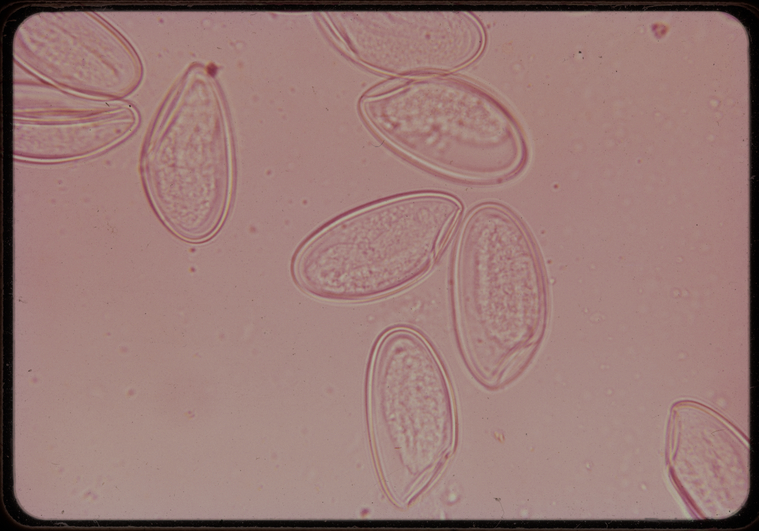 Pin worm - NYPL Digital Collections